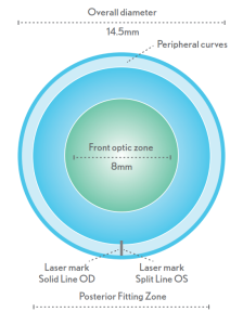 Kerasoft IC - SkyVision